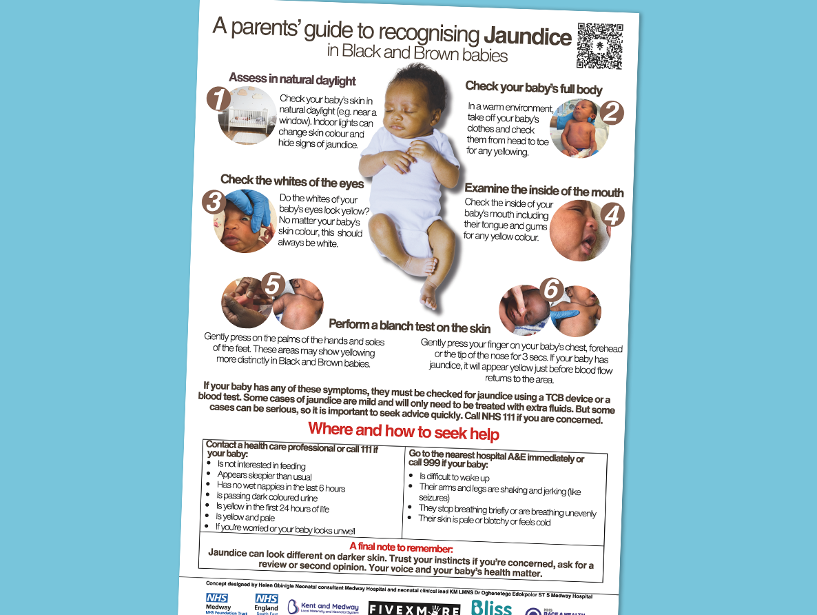 Jaundice in Black and Brown babies - NHS – Race and Health Observatory